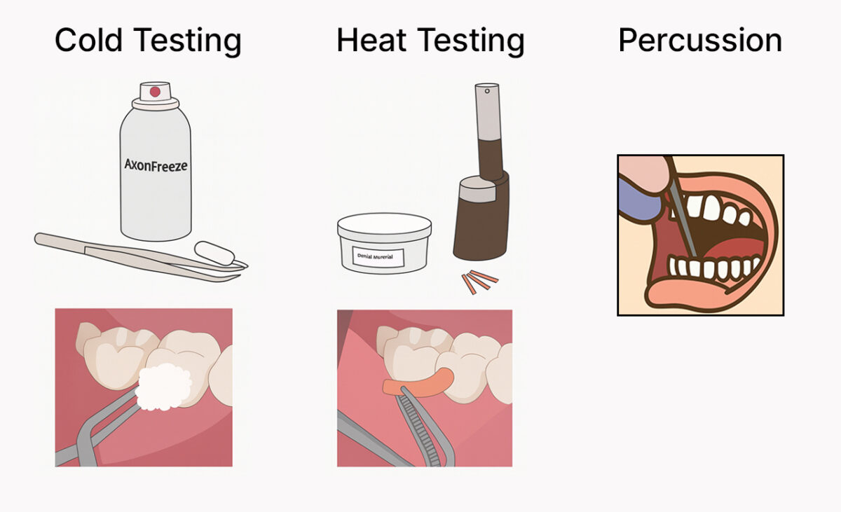 Electric Pulp Testers Vs Conventional Pulp Vitality Tests - Parkell Europe